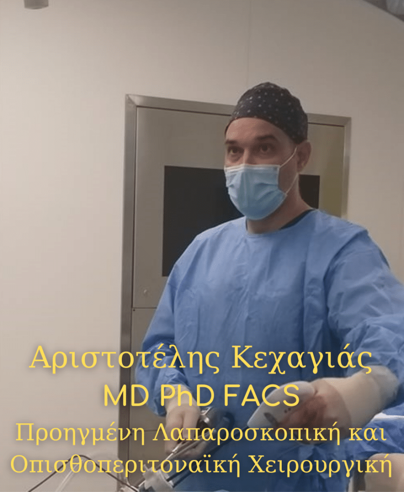 Λαπαροσκοπική Αφαίρεση Χοληδόχου Κύστης με την Απόλυτα Ασφαλή Τεχνική ...