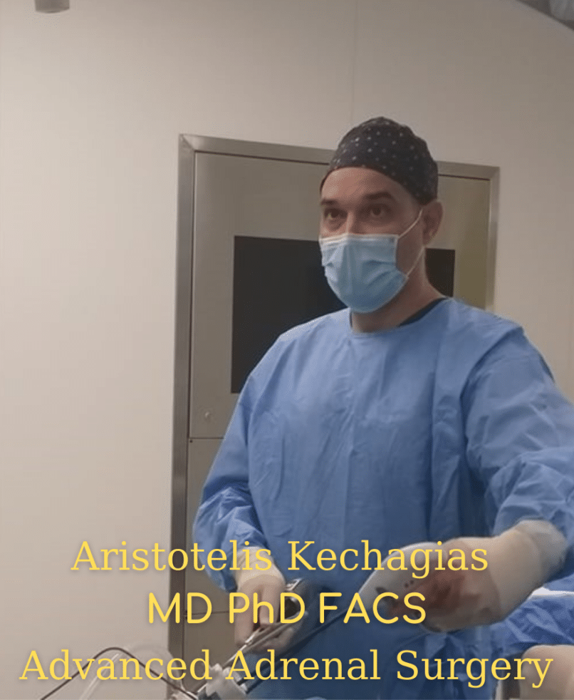 Αδένωμα επινεφριδίου: Τι πρέπει να γνωρίζουμε - Γενικος Χειρουργος ...